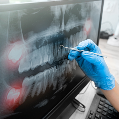 Radiography and Radiation Protection - Smilewisdom