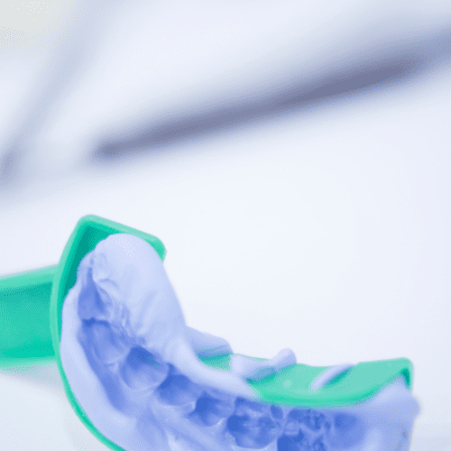 Patient Impression Taking - SmileWisdom Dental Nurse Training