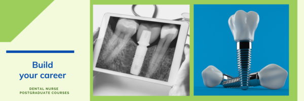 Dental Implant nursing | NEBDN Implant | Dental nursing